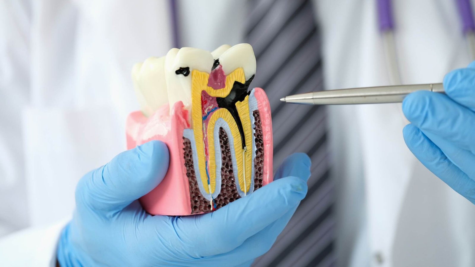 What Small Cavities Look Like & When to Seek Care